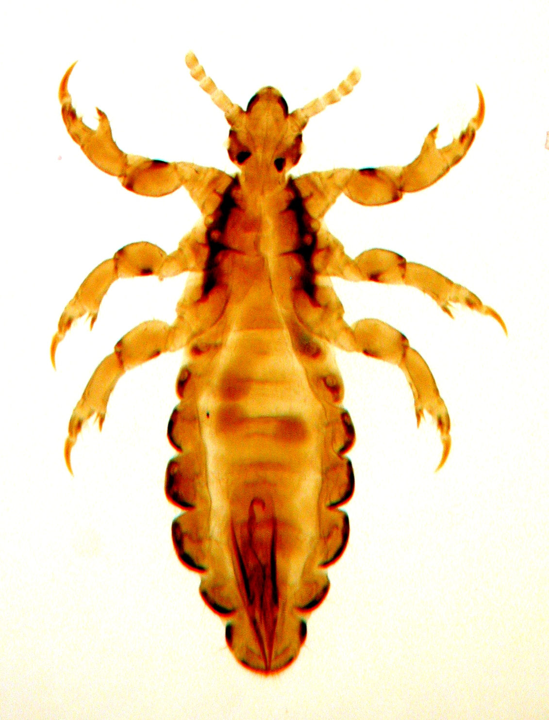 >> Lus - her er en effektiv kur